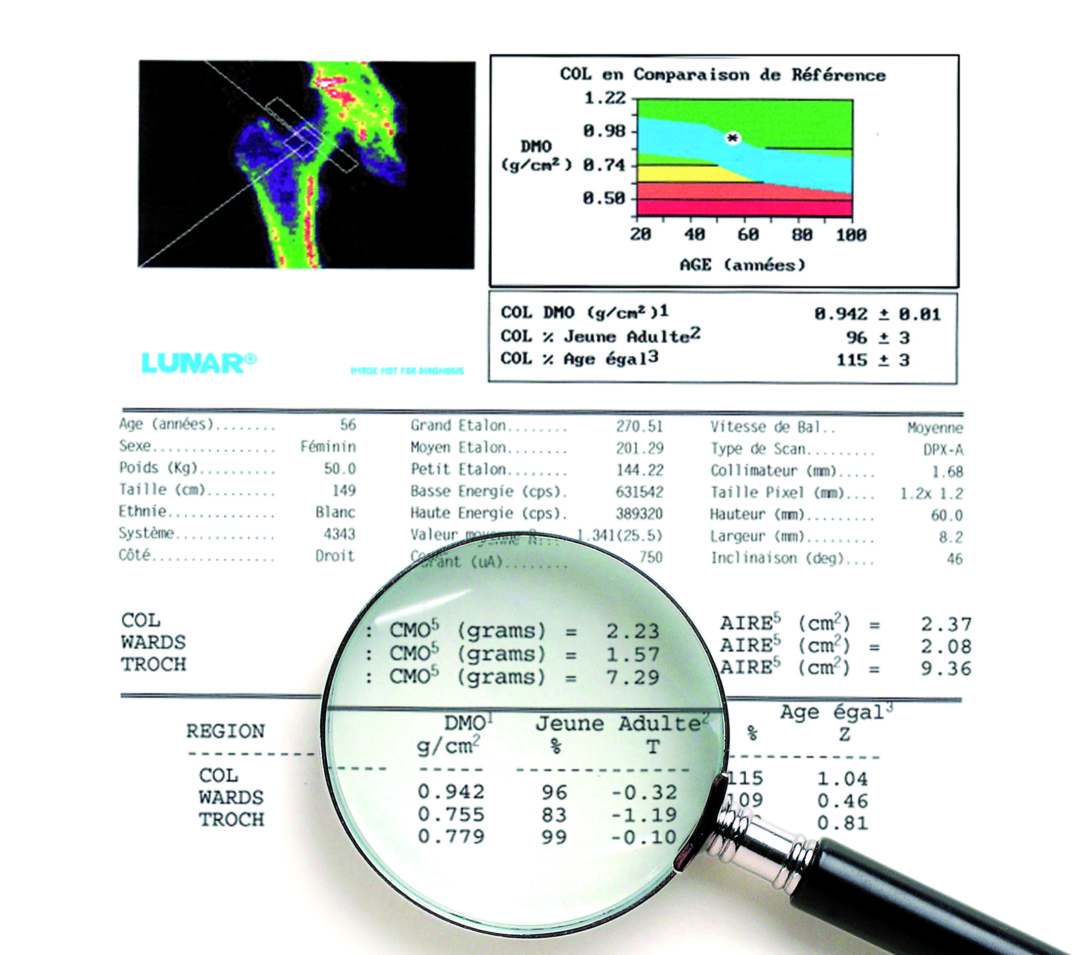 Comprendre les résultats de votre osteodensitométrie - Soignez-vous