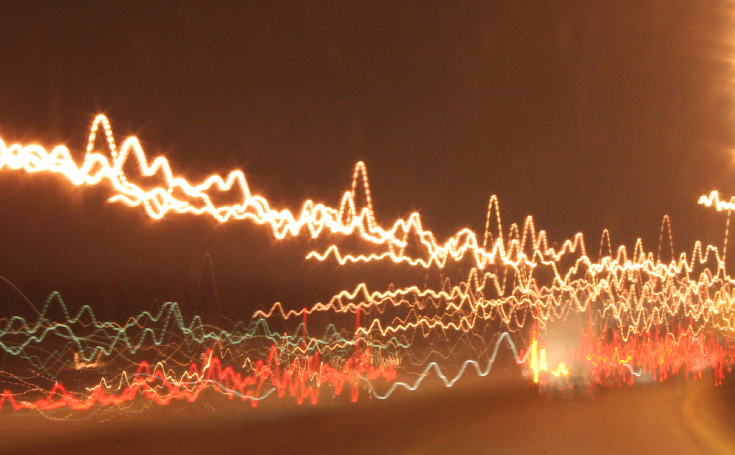 Comprendre les résultats de votre électro-encéphalogramme - Soignez-vous