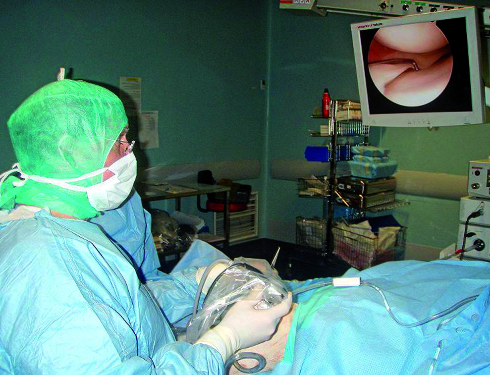 Comprendre les résultats de votre arthroscopie - Soignez-vous