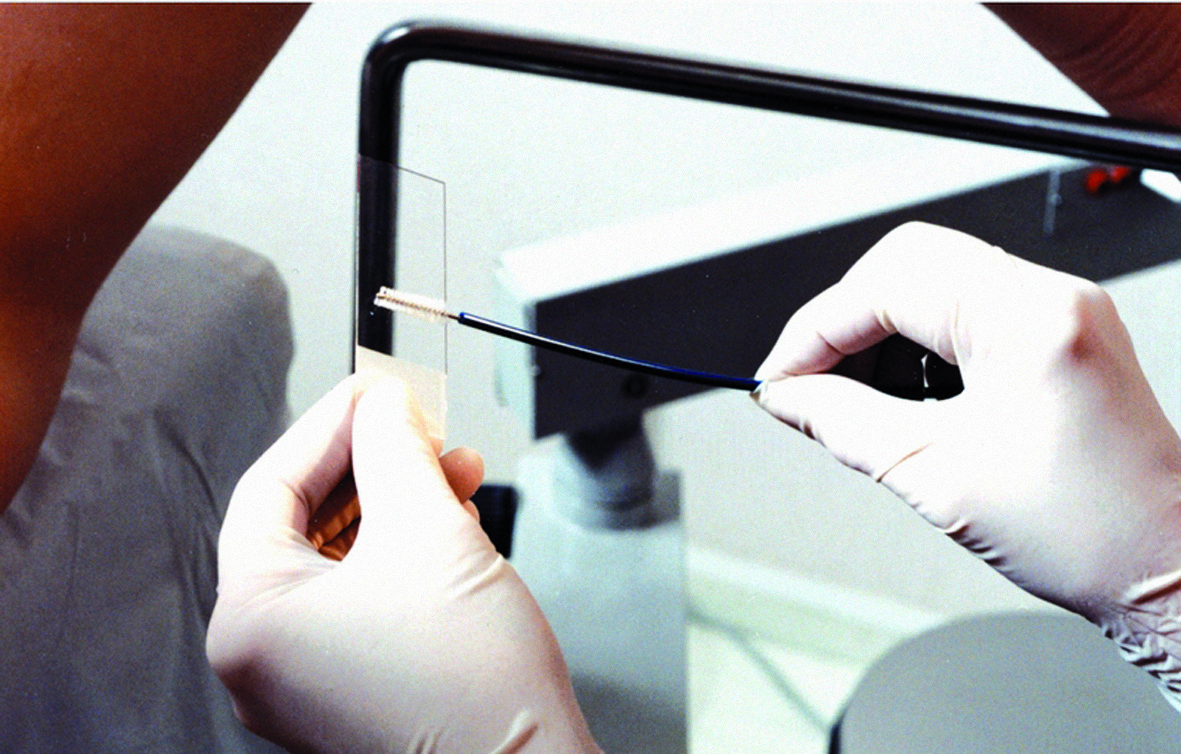 Le frottis cervico-vaginal - Analyses - Soignez-vous